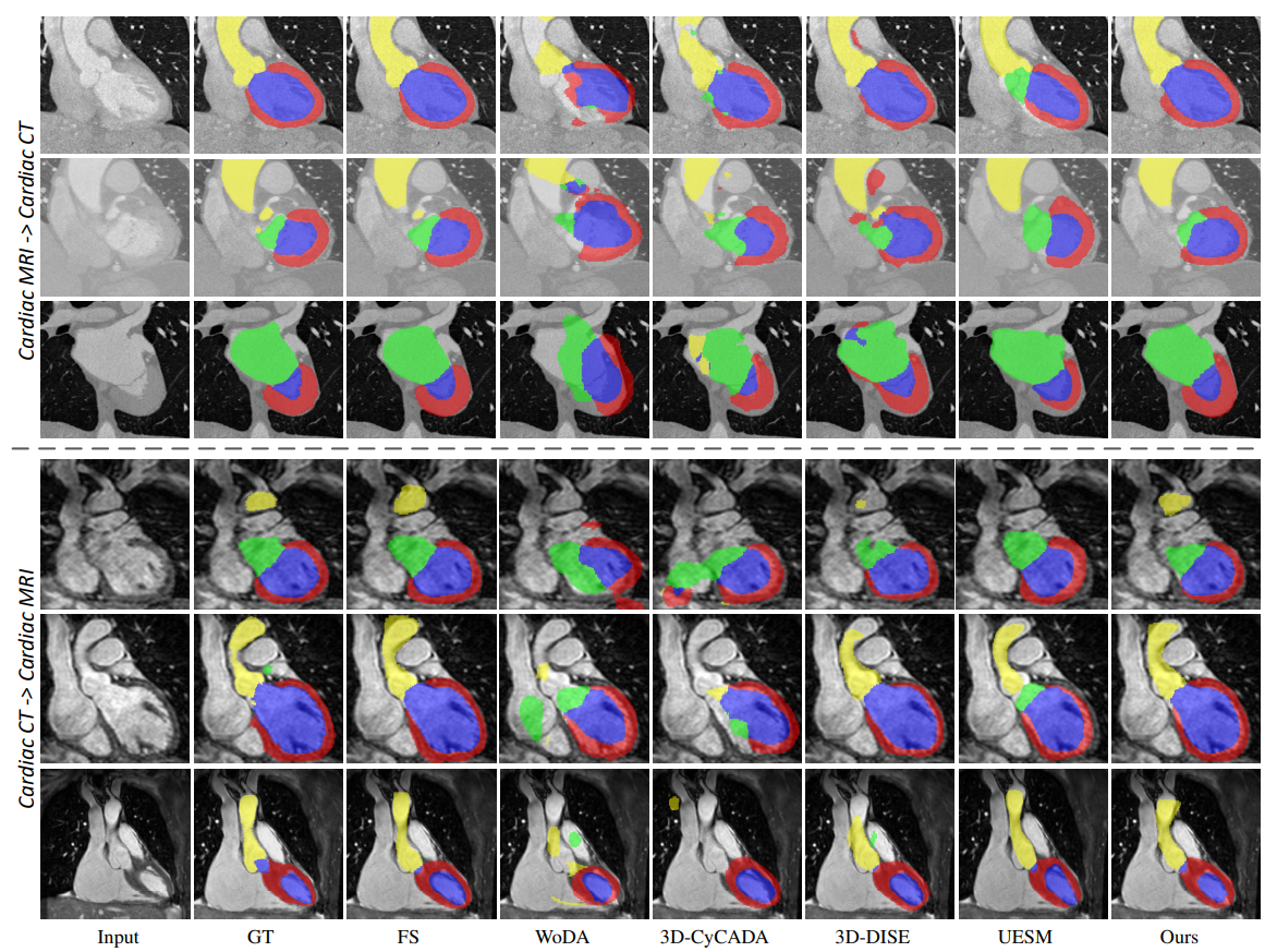 Structure-Driven Unsupervised Domain Adaptation for Cross-Modality Cardiac Segmentation