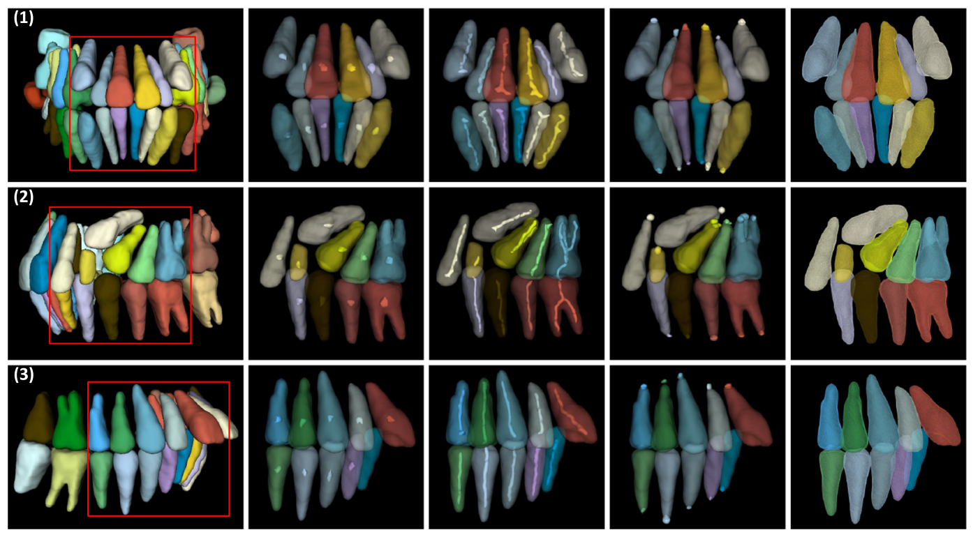 Hierarchical Morphology Guided Tooth Instance Segmentation From Cbct Images
