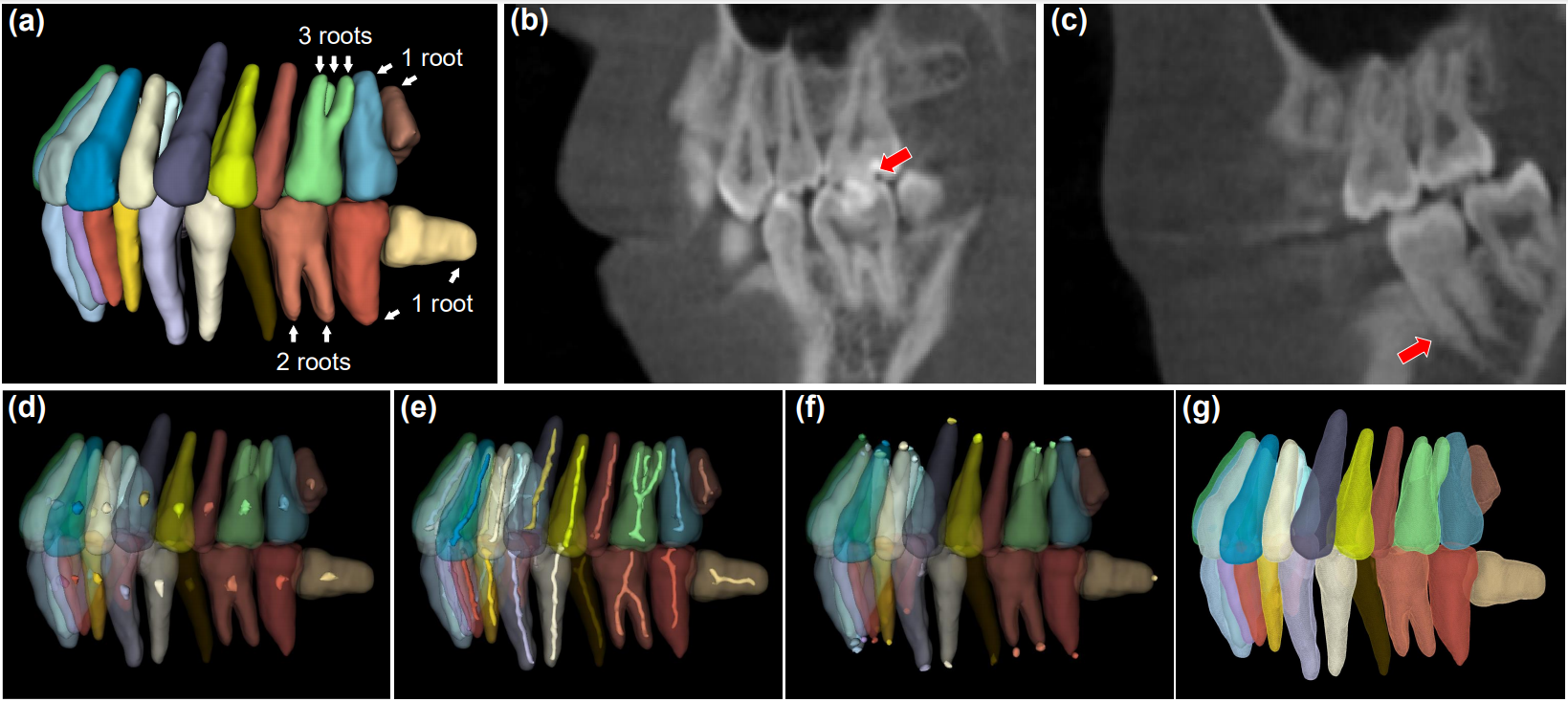 Hierarchical Morphology-Guided Tooth Instance Segmentation from CBCT Images Hierarchical Morphology-Guided Tooth Instance Segmentation from CBCT Images