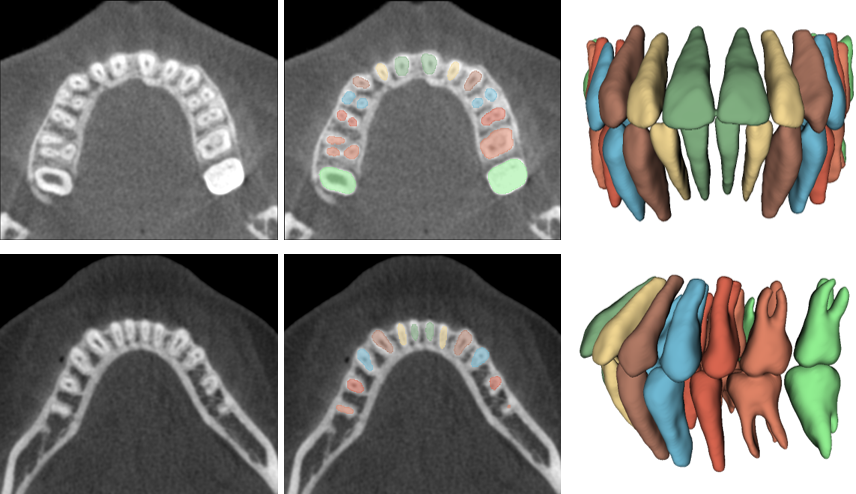 ToothNet: Automatic Tooth Instance Segmentation and Identification from Cone Beam CT Images