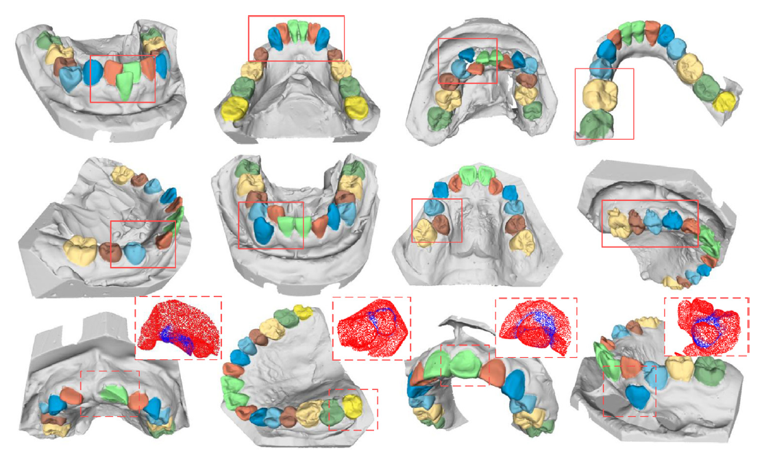 TSegNet: An Efficient and Accurate Tooth Segmentation Network on 3D Dental Model